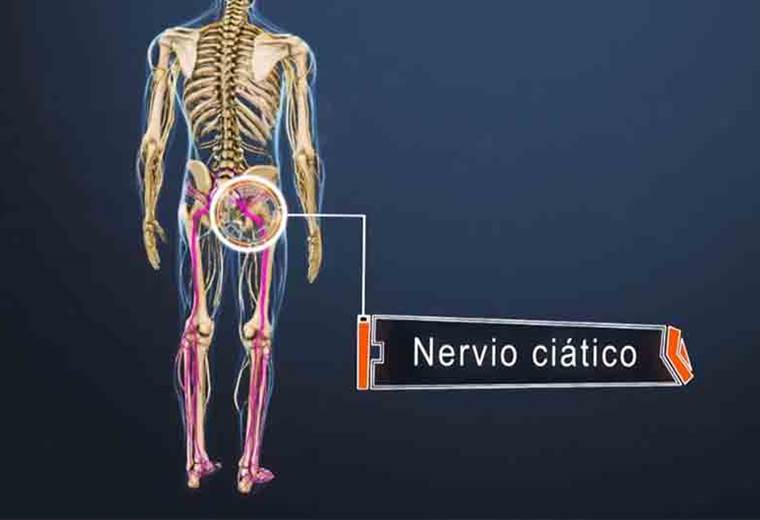 ¿qué Es El Nervio Ciático Teletica