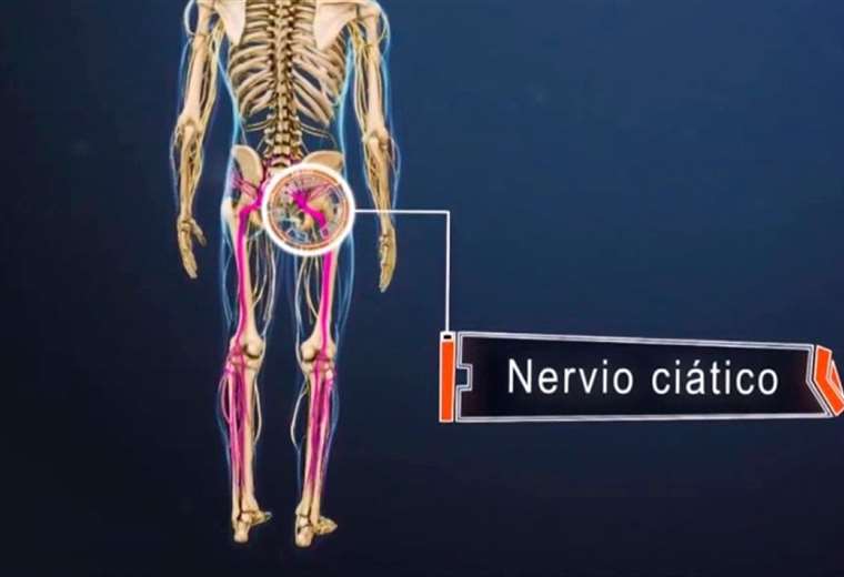 Médico explica el manejo adecuado de la ciática | Teletica