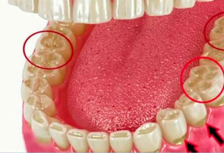 Conozca los tratamientos para la quebradura dental | Teletica