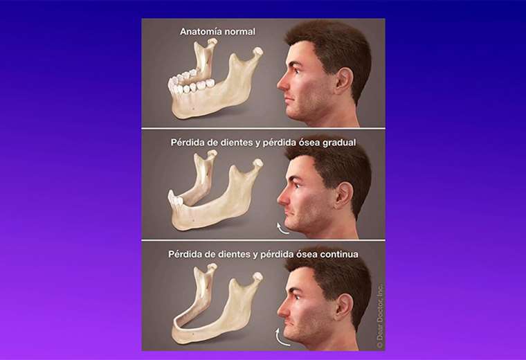 ¿Dientes flojos? Conozca sus causas y tratamientos | Teletica